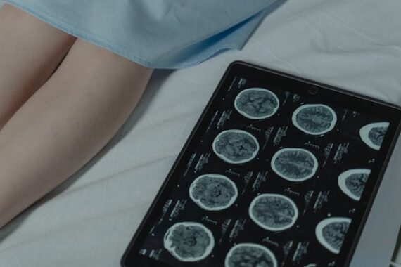 Understanding The Support Needs Of People With Acquired Brain Injury