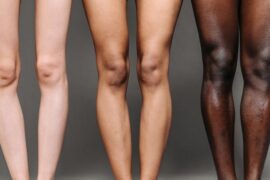 Why Leg Health Is A Key Part Of Overall Wellness