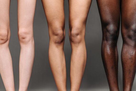 Why Leg Health Is A Key Part Of Overall Wellness